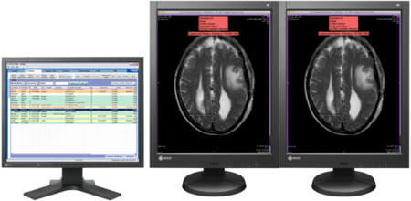 Medical PACS - workflow - aycan Medical Systems - medical imaging