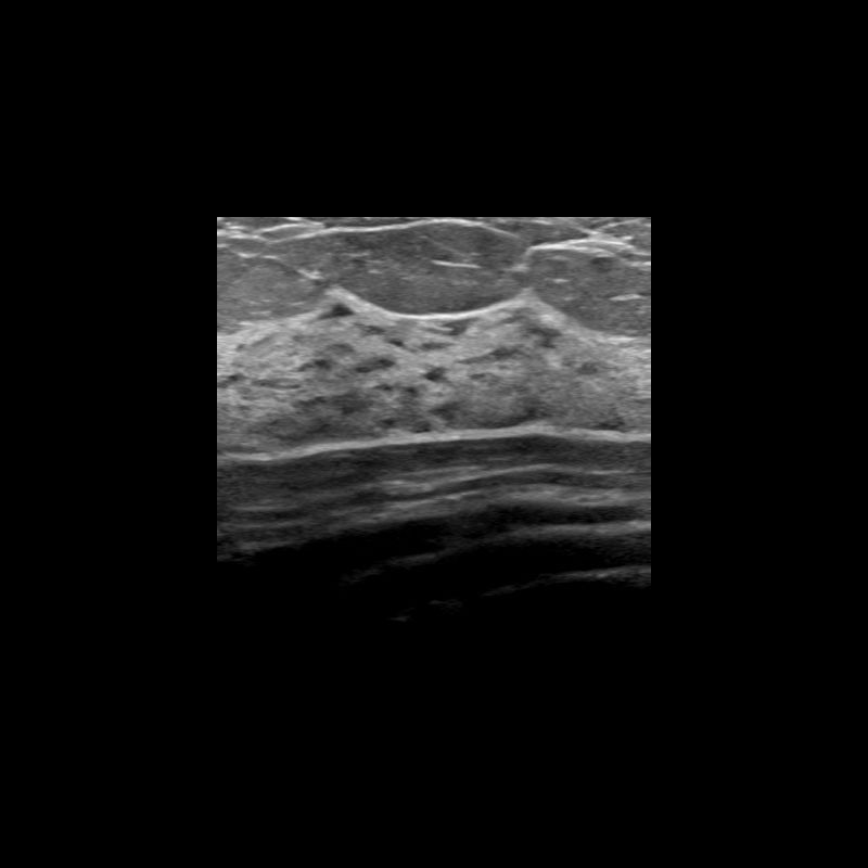 Image enhancement software - Rivent™ - ContextVision - clinical / for ...