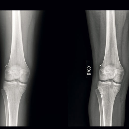 Visualization software - ContextVision - radiography / for orthopedic ...