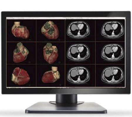 Diagnostic display - GEMINI-6MP - Double Black Imaging - 30.4in / LCD / LED