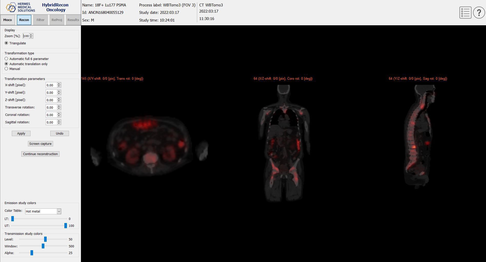 Quality control software - SUV SPECT® - Hermes Medical Solutions, Inc ...