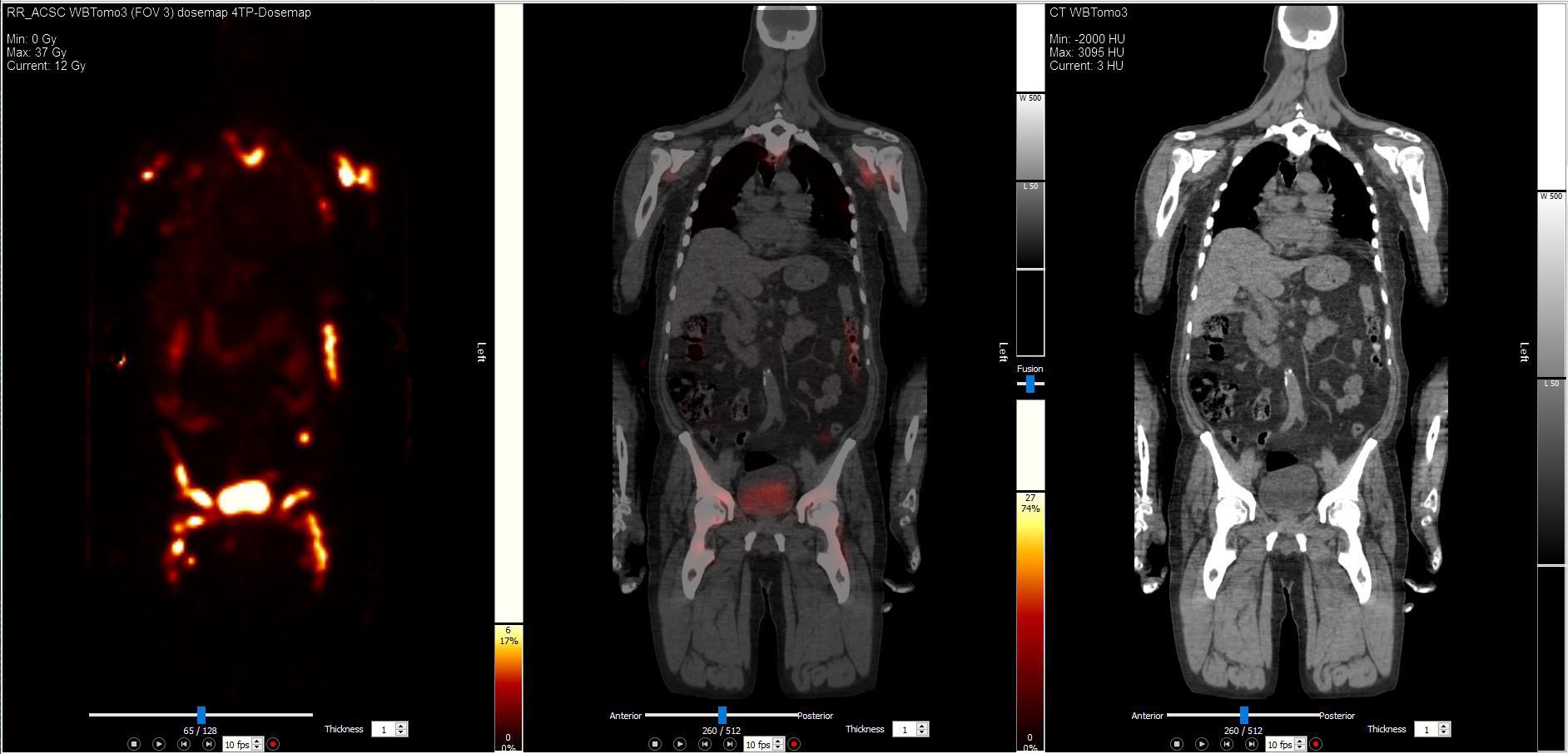 Clinical software - Voxel dosimetry™ - Hermes Medical Solutions, Inc - CT / PET / SPECT