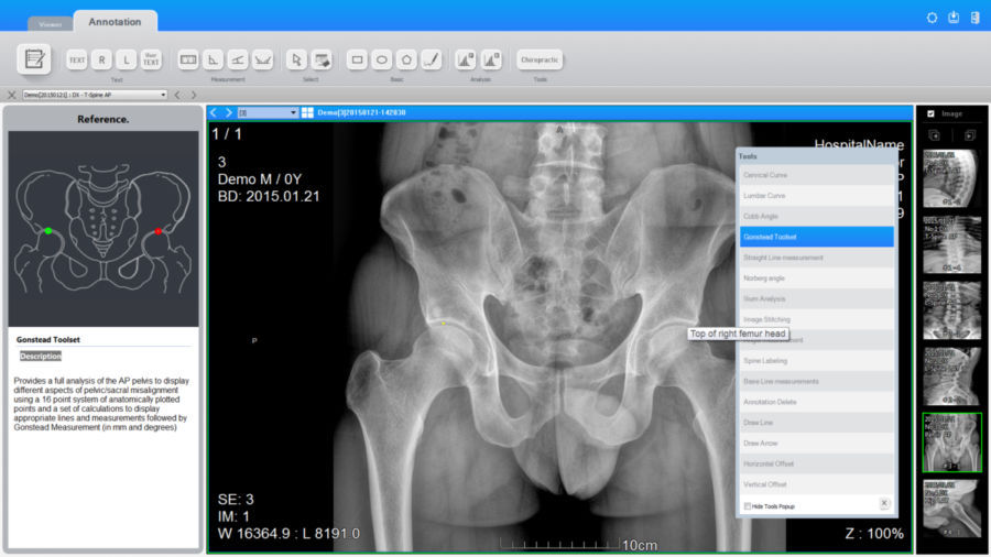 Clinical software - ExamVue PACS - JPI Healthcare Solutions - medical ...