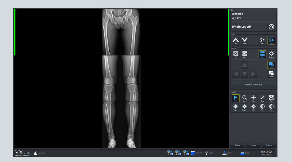 Management software / viewer / acquisition / radiography - VXvue with PureImpact™ - Vieworks