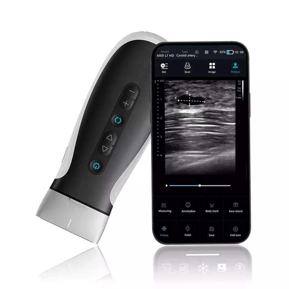 Hand-held ultrasound system - MX9V - Viatom by Lepu - for multipurpose ...