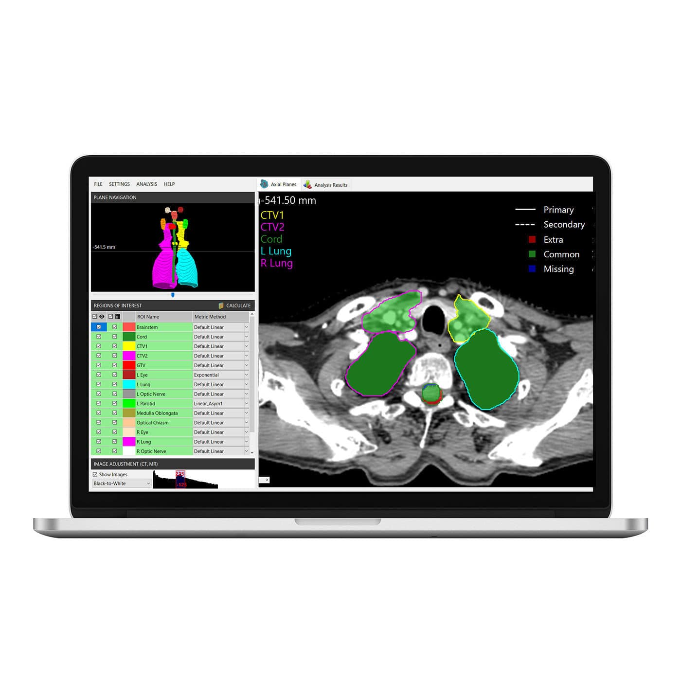 Analysis software - StructSure™ - Standard Imaging - test / contouring ...