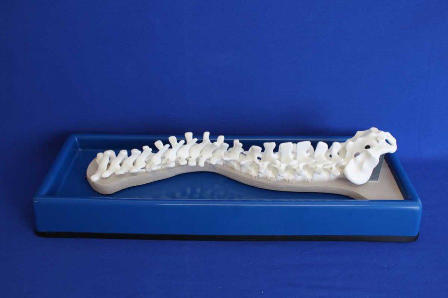Vertebral column model - SDEP - Créaplast - scoliosis