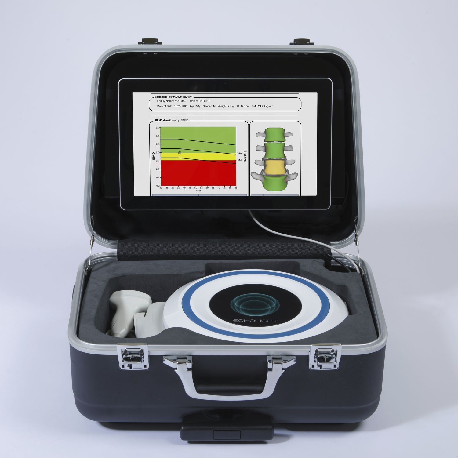 Ultrasound bone densitometer - EchoS - Echolight - for femoral neck ...