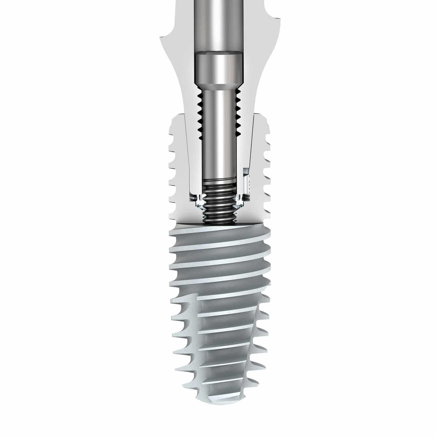 Cylindro-conical dental implant - Kontact S - BIOTECH DENTAL - titanium ...