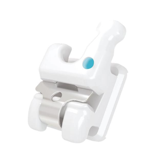 Ceramic orthodontic bracket - Thomas C - Creative Dental