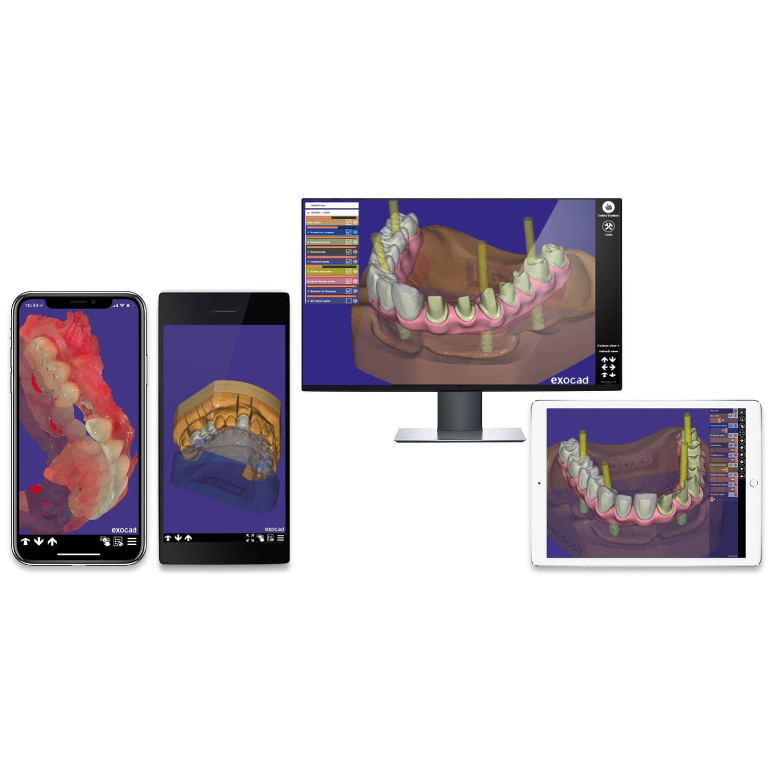 CAD software - EXOCAD CAD - Open Tech 3D Srl - dental / dental