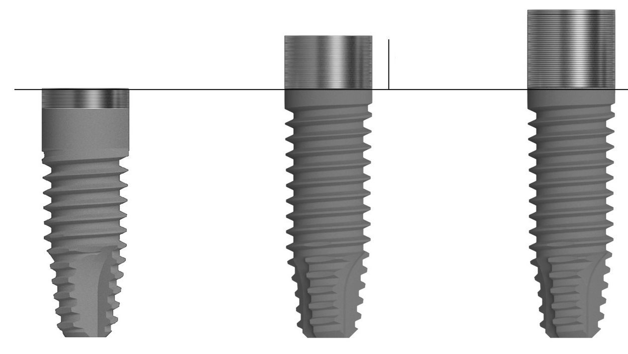 Cylindro-conical dental implant - P-Slim - Sweden & Martina - titanium ...