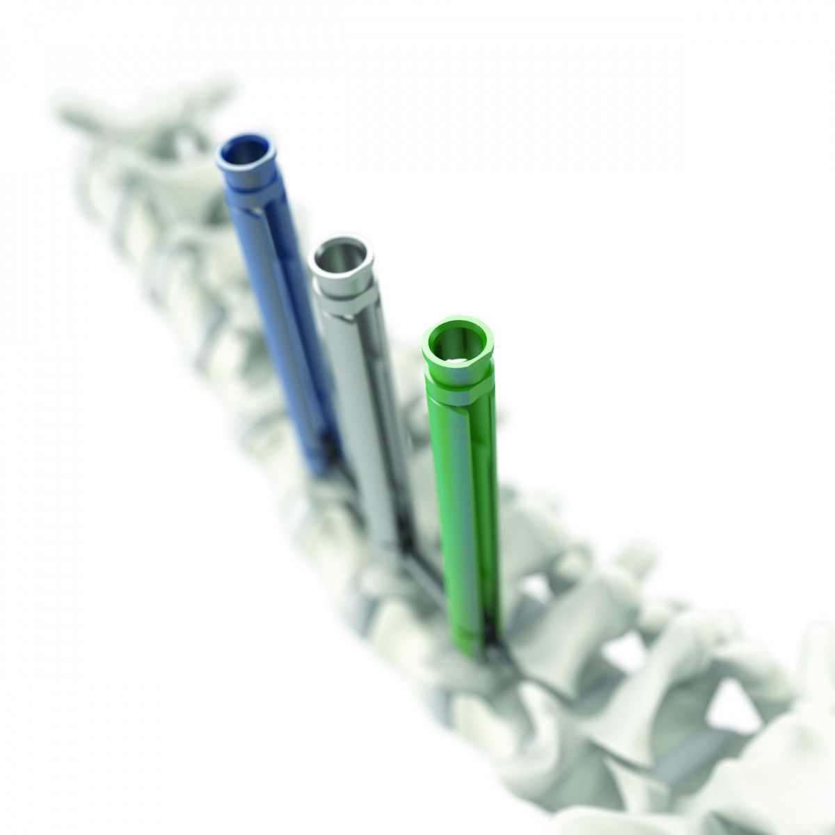 Minimally invasive pedicle screw positioning system - Streamline® - RTI ...