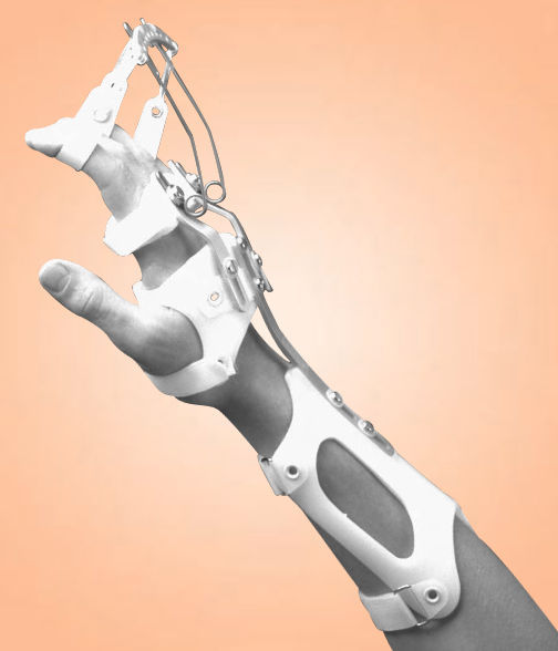 Finger orthosis - UM-2.2 series - Becker Orthopedic - metacarpal ...