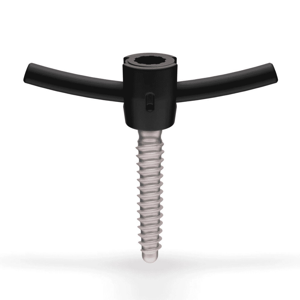 Cannulated pedicle screw - CarboClear® - CarboFix Orthopedics - titanium