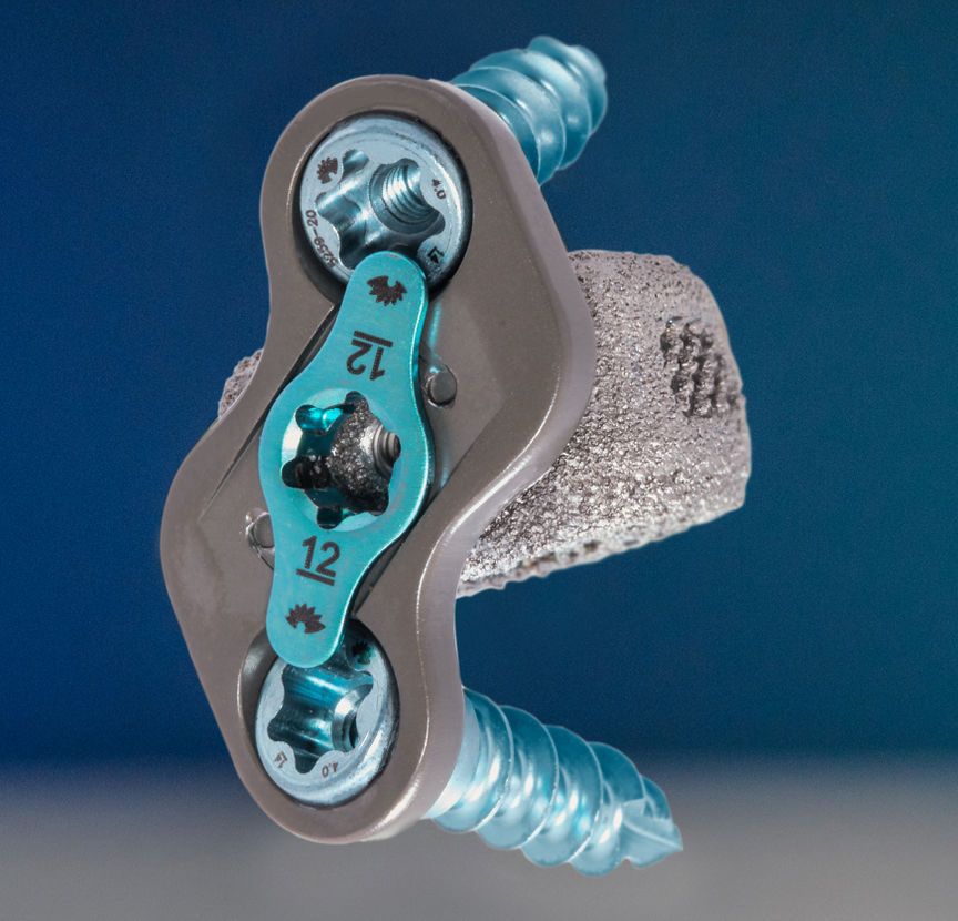 Cervical interbody fusion cage - Boomerang™ - ChoiceSpine - anterior ...