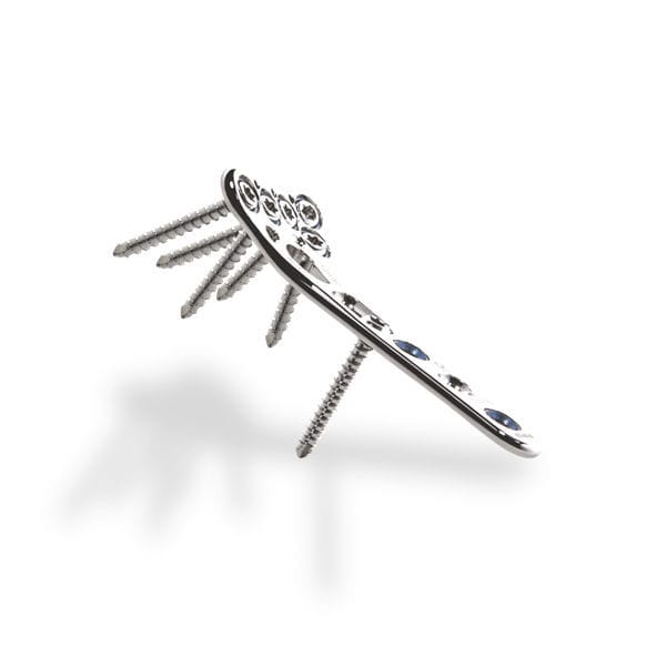 Radius compression plate - PL8 - Citieffe - distal / anteromedial / locking