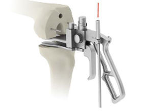 Fixed-bearing knee prosthesis - MRK™ - MatOrtho - cemented or non-cemented