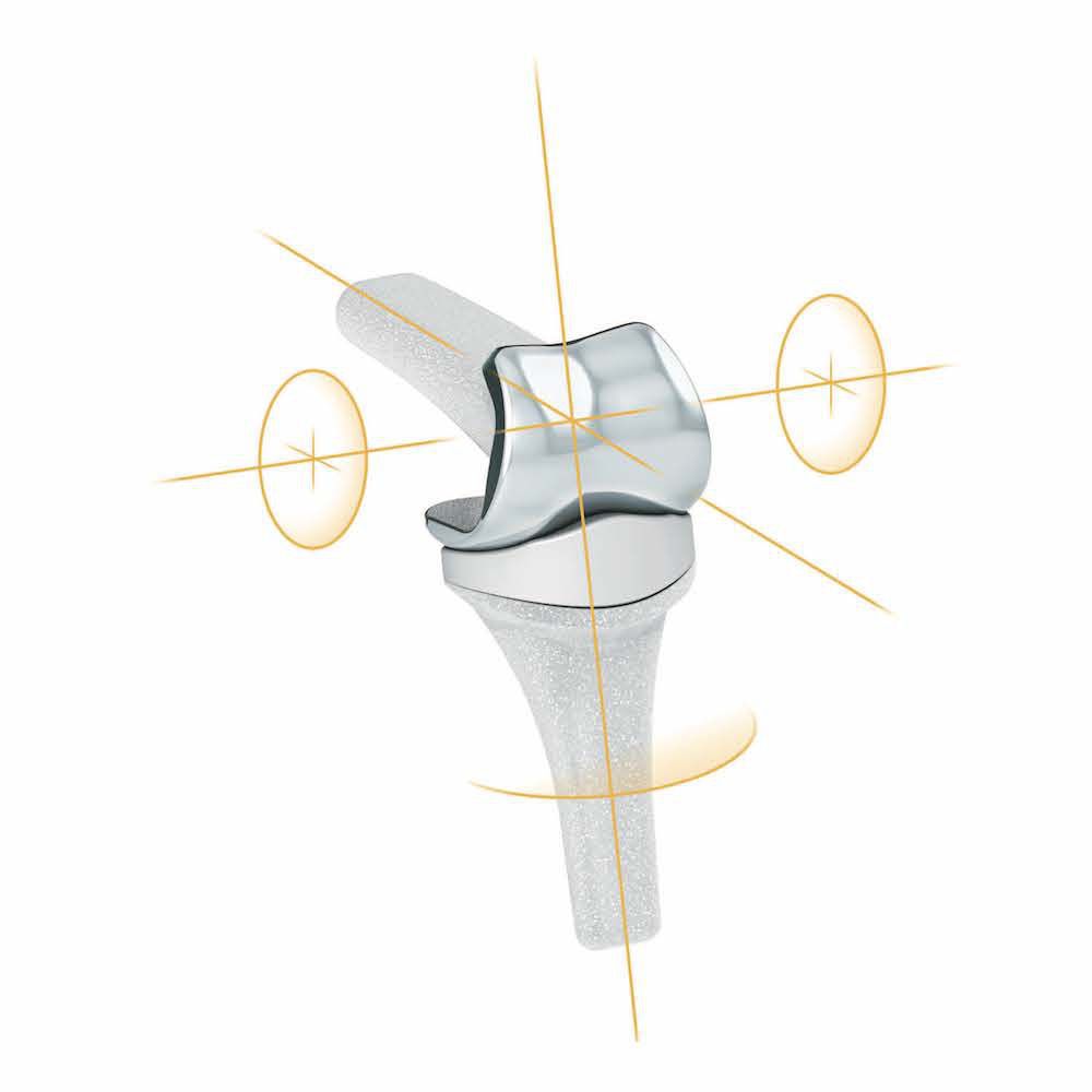 Interphalangeal hand joint implant - PIPR™ - MatOrtho