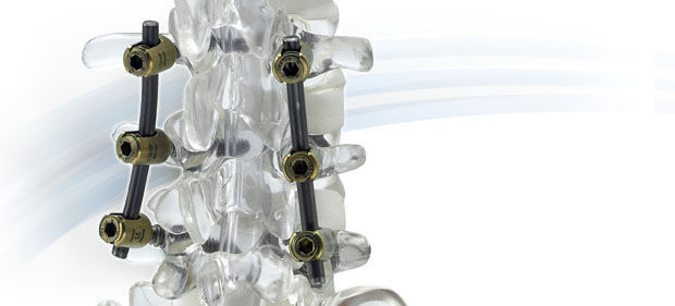 Thoraco-lumbar spinal osteosynthesis unit - Zenius™ - Medyssey Spine ...
