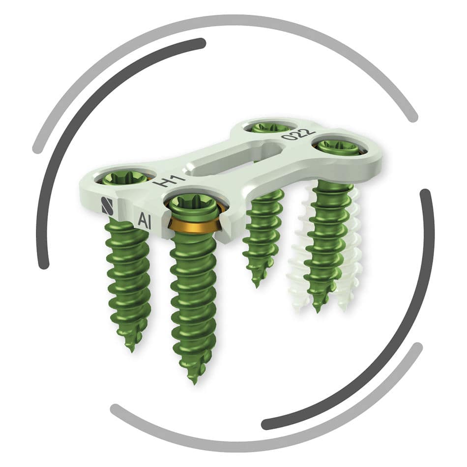 Cervical arthrodesis plate - ASCOT - Signus Medical - locking