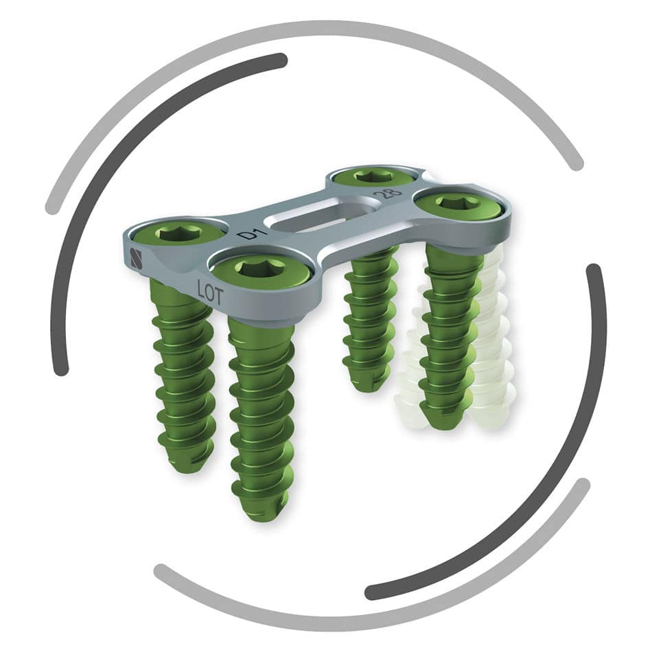 Cervical arthrodesis plate - TOSCA Standard - Signus Medical