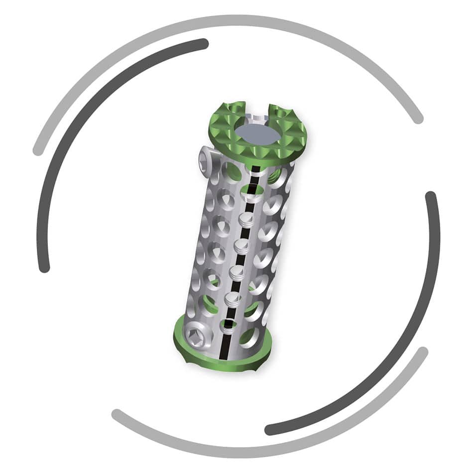 Cervical vertebral corpectomy prosthesis - PALIO - Signus Medical