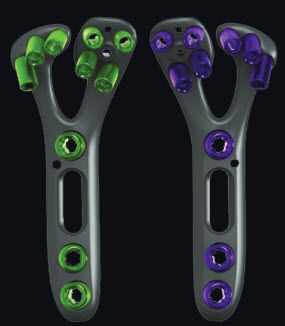 Radius compression plate - GEMINUS ® - Skeletal Dynamics - distal