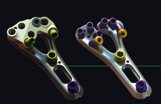 Radius compression plate - GEMINUS ® - Skeletal Dynamics - distal