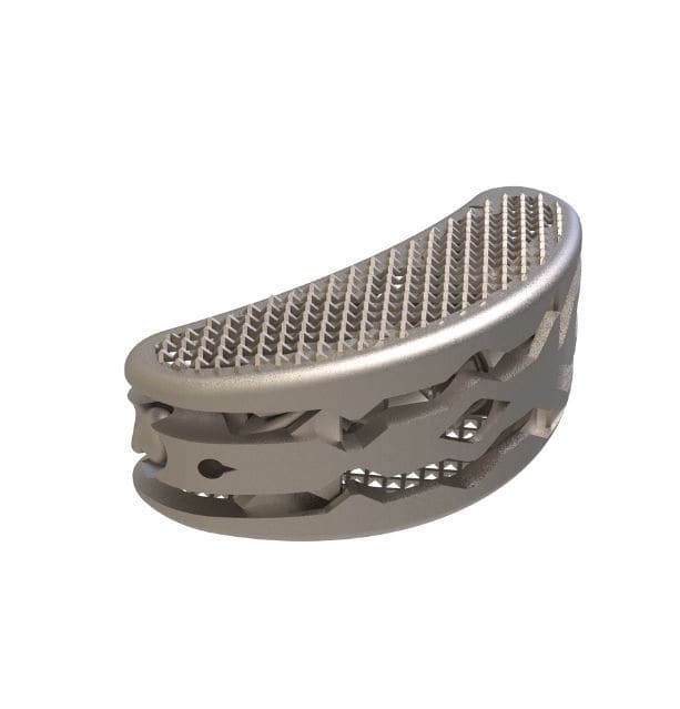 Lumbar interbody fusion cage - Ustica TLIF - Tsunami Medical ...