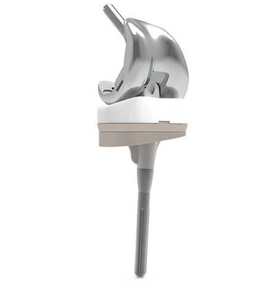 Total knee prosthesis - Rhino® - South America Implants - revision