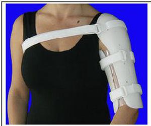Humeral splint - 3212 series - Tiburon Medical Enterprises - L / M / S
