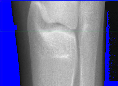 Control software - Scanco Medical - measurement / scan / calibration