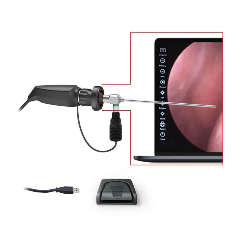 Endoscope camera head - HD-602K-2 - Nanjing Keweisi Medical Lighting ...