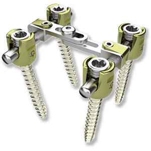 Thoraco-lumbar osteosynthesis unit - ON PLUS - Osimplant - posterior ...