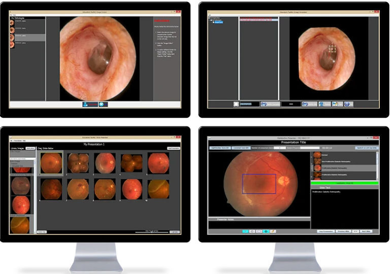 Training software - Educators Toolkit™ - OtoSim Inc. - medical image ...