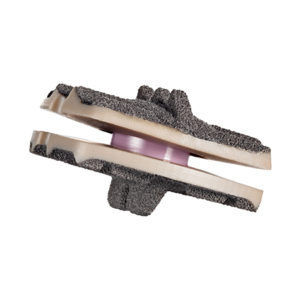 Cervical disc prosthesis - CTDR - NuVasive