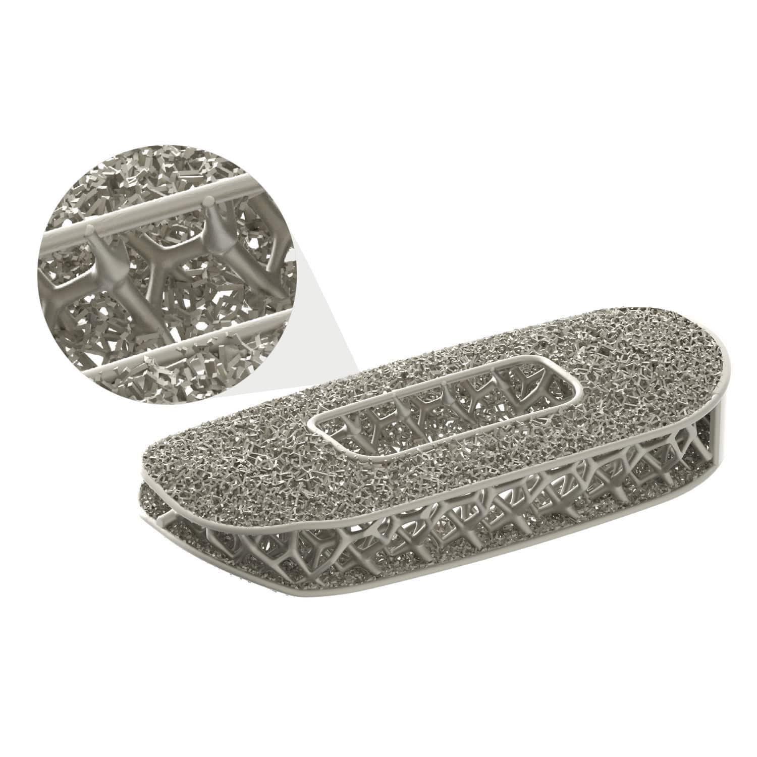 Cervical interbody fusion cage - Modulus® - NuVasive - anterior / titanium