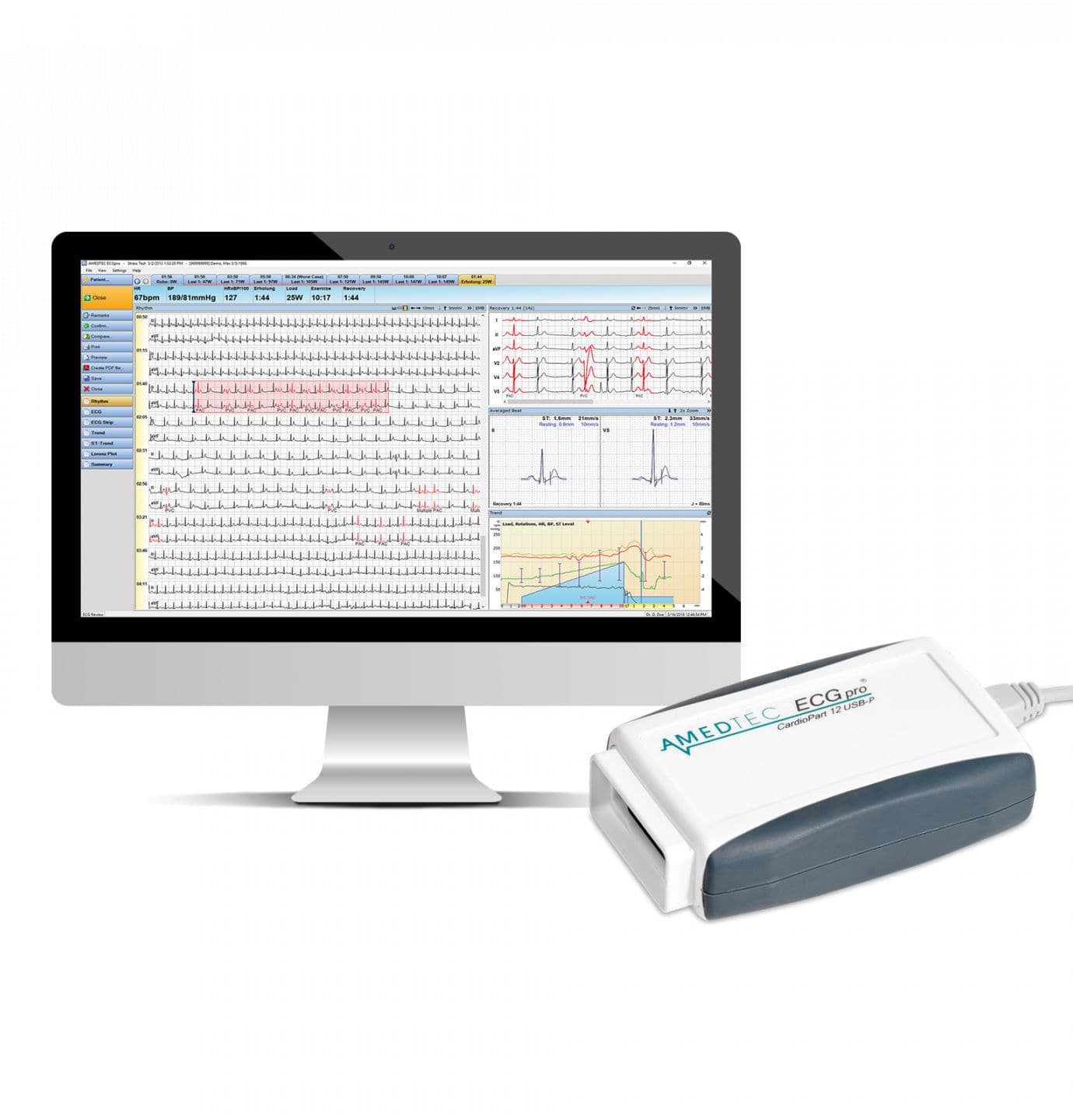 Resting electrocardiograph - AMEDTEC Medizintechnik - stress test / 12 ...