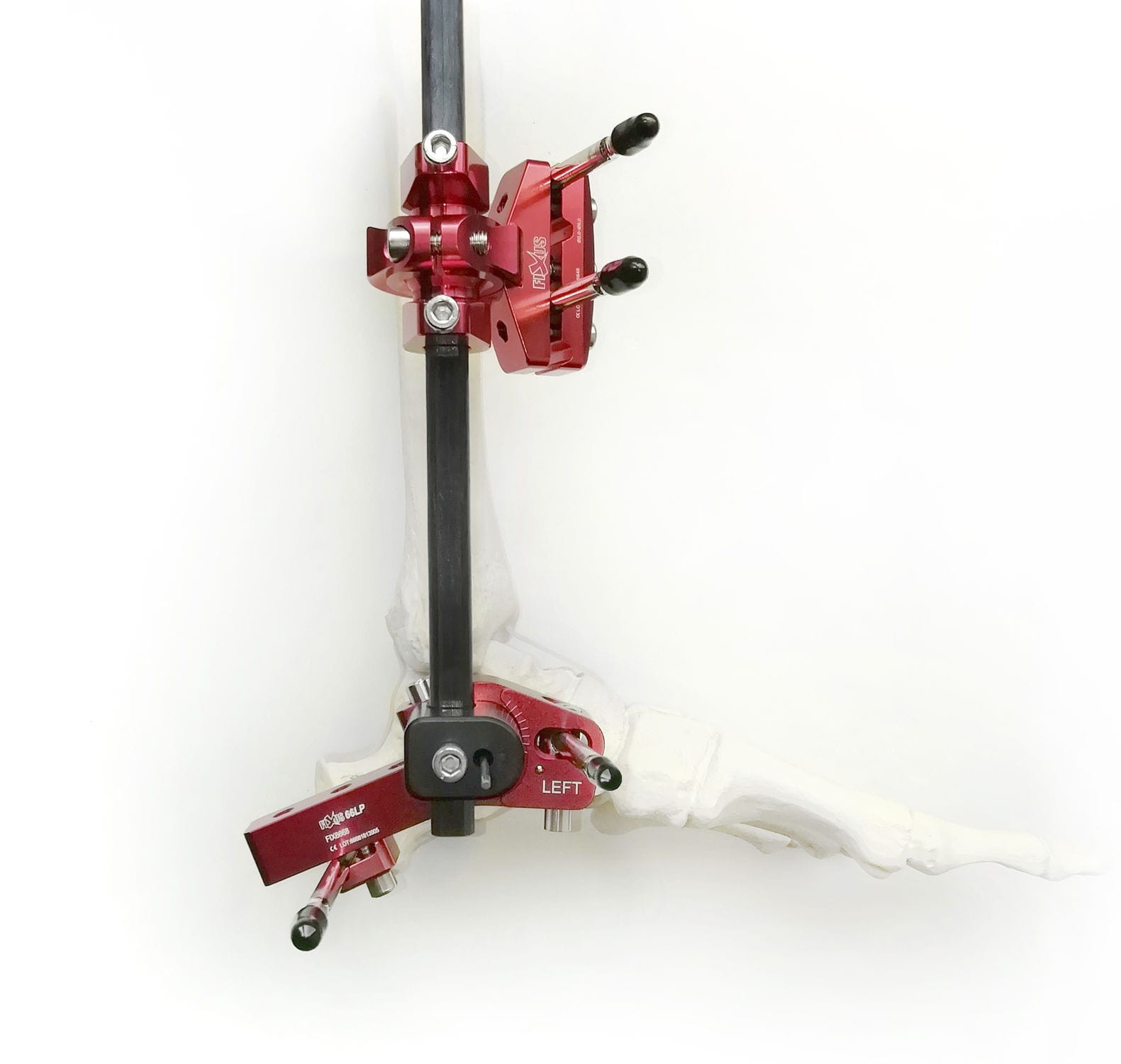 Tibia external fixation system - FIXUS66LP - Fixus - ankle / calcaneus ...