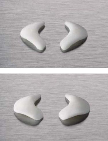 Nasal implant - OP9519 - Matrix Surgical USA - anatomical / polyethylene