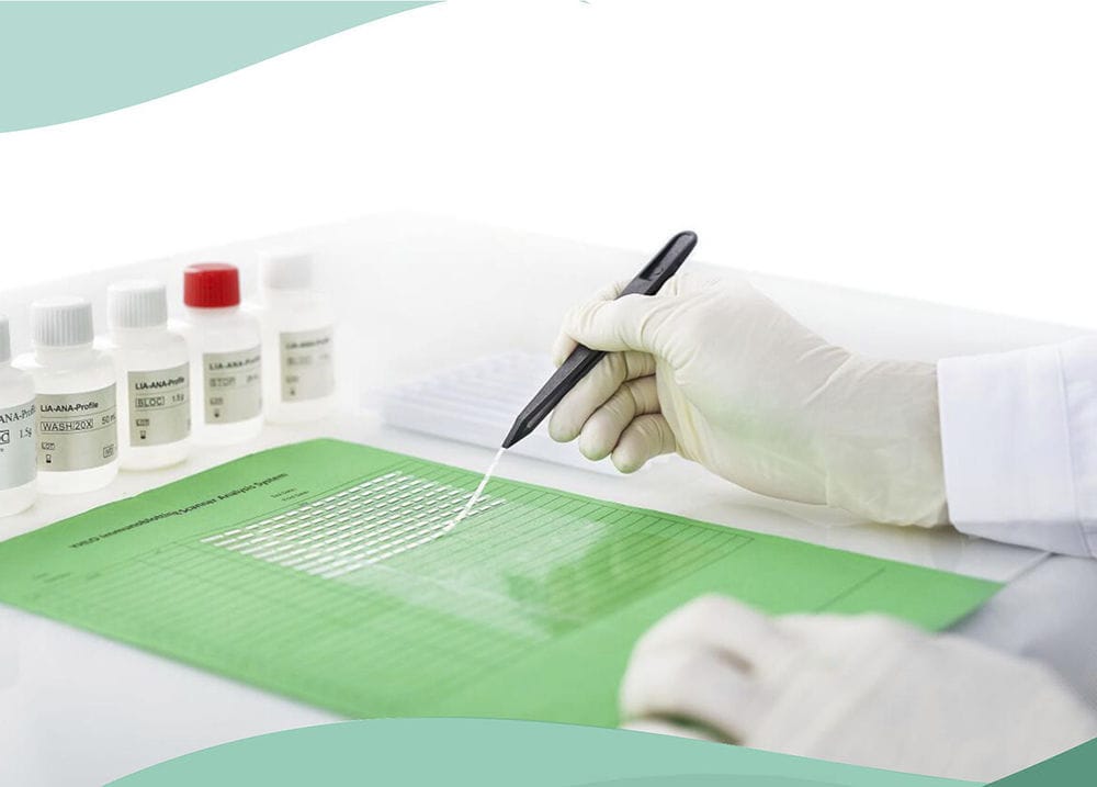 Autoimmune disease test strip - Shenzhen Yhlo Biotech Co., Ltd. - for ...