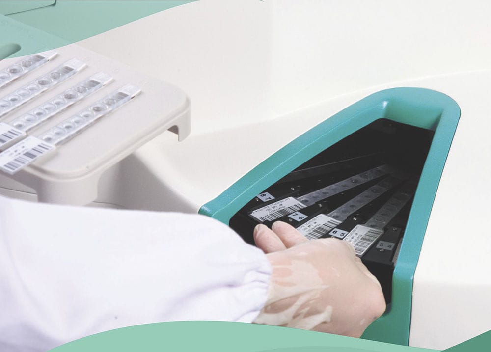 Autoimmune disease test strip - Shenzhen Yhlo Biotech Co., Ltd ...