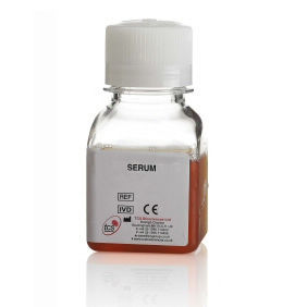 Rabbit serum reagent - H110 - TCS Biosciences Ltd - for microbiology ...