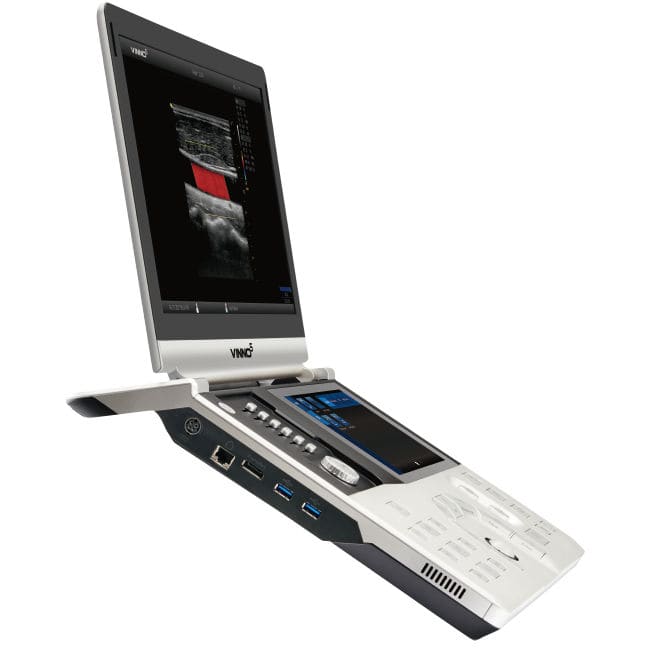 Portable ultrasound system - VINNO 5 - VINNO - for gynecological and ...