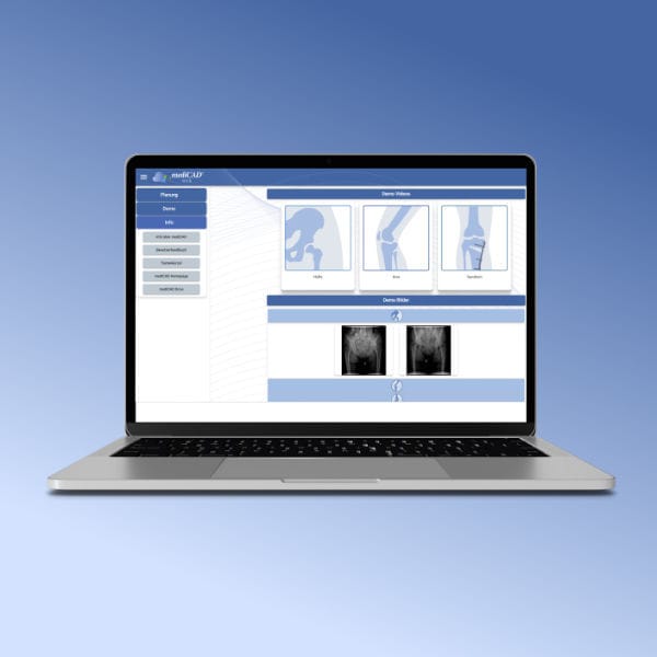 Management software - mediCAD Hectec GmbH - planning / preoperative ...