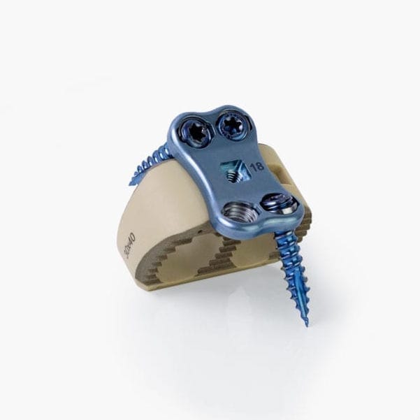 Lumbar interbody fusion cage - Idys®-ALIF - Clariance - anterior / PEEK ...