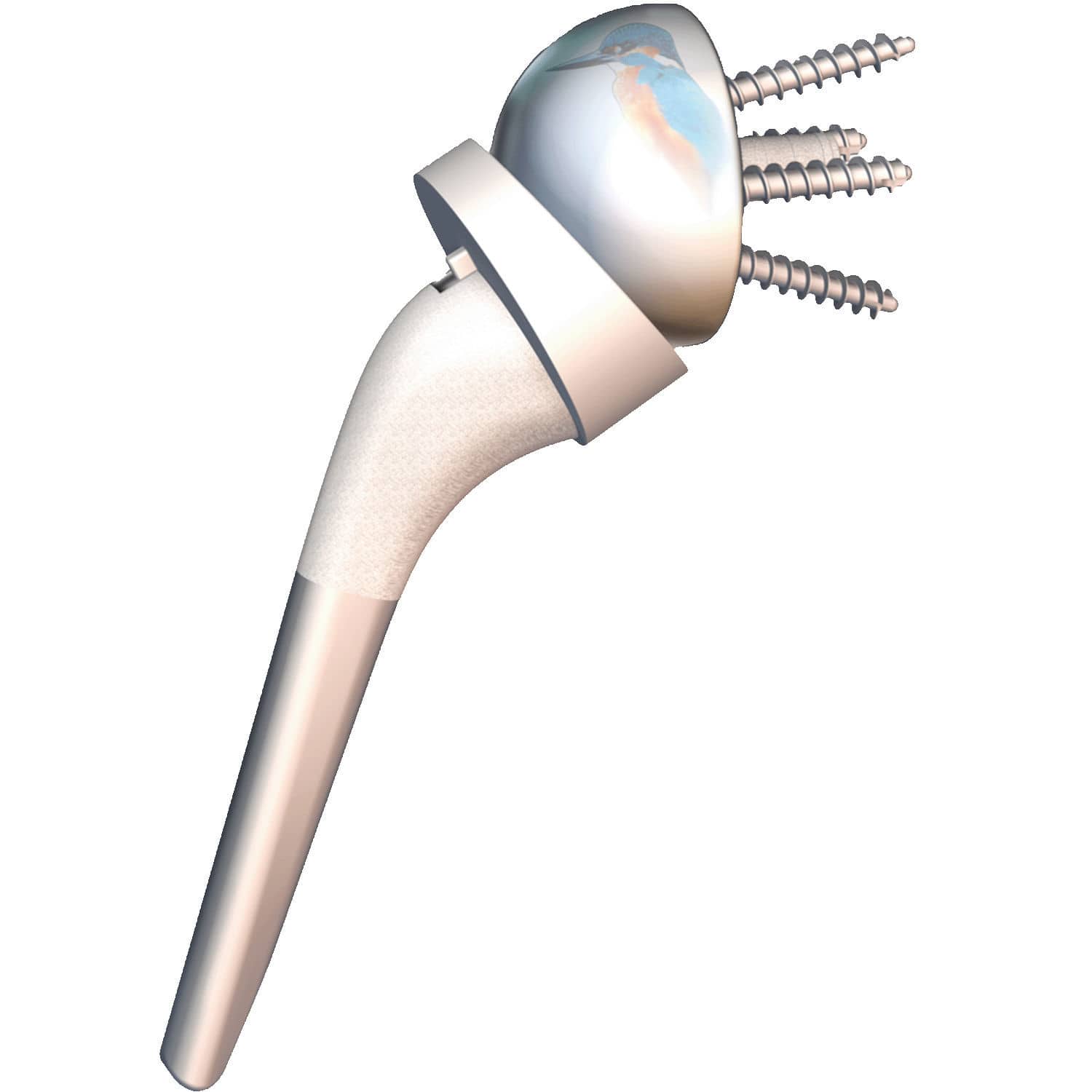 Reverse shoulder prosthesis - HUMERIS® - FX Solutions - cementless