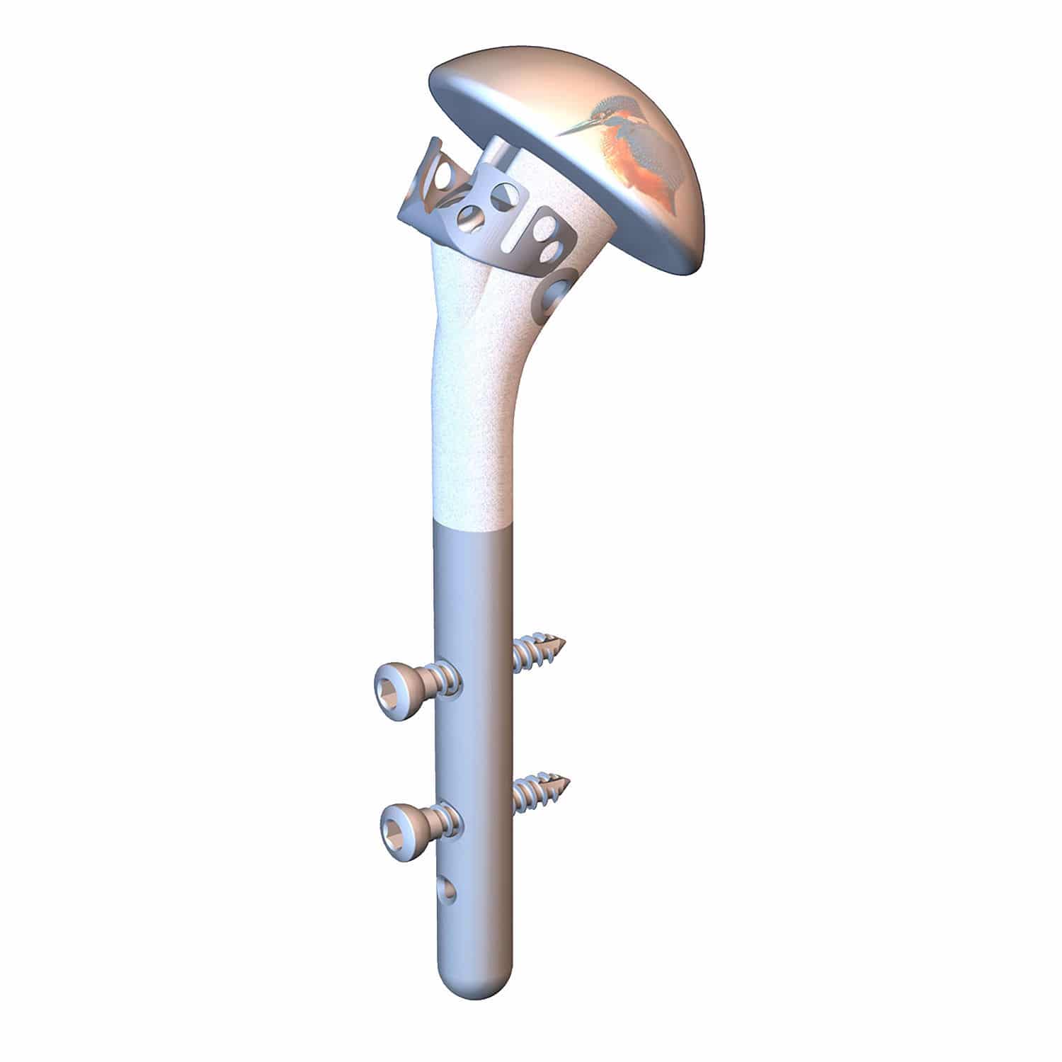 Revision humeral stem - HUMELOCK II ® HEMI - FX Solutions - cemented or ...