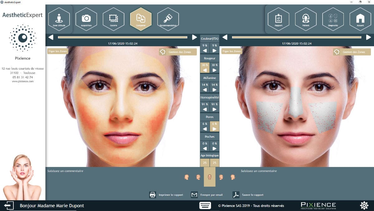 Image analysis software module - Pixience - dermatology / aesthetic medicine / skin